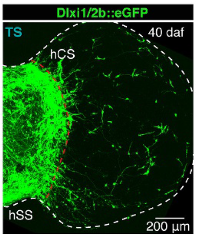 Studying the neuropsychiatric spectrum of Timothy Syndrome, from cells ...