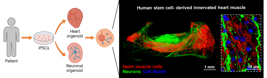Investigating Timothy Syndrome in a new innervated heart muscle model ...